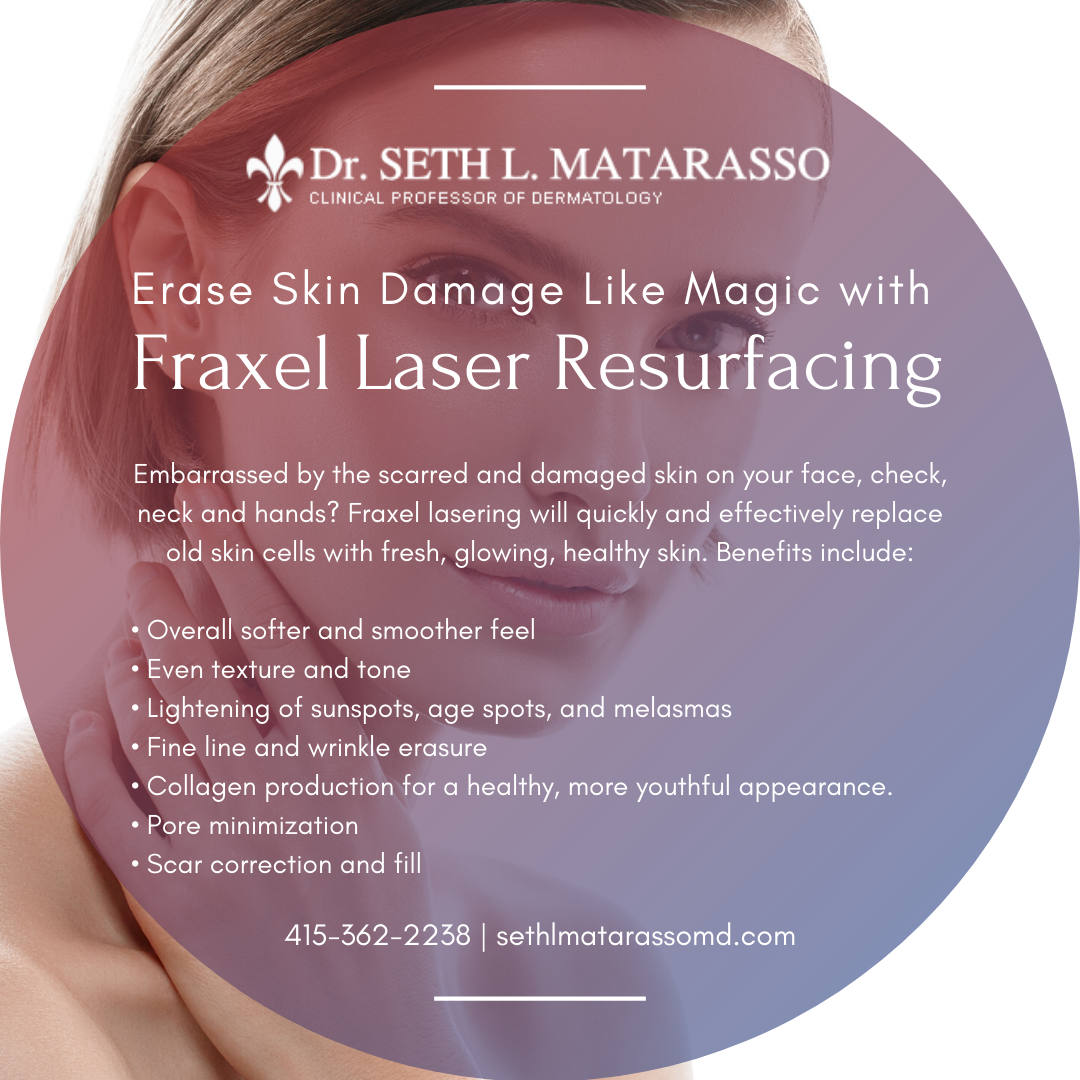 Fraxel Laser Treatments San Francisco | Dr. Seth L. Matarasso